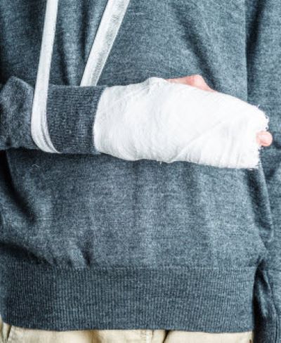 Hand Injuries After Slips and Falls in Tampa